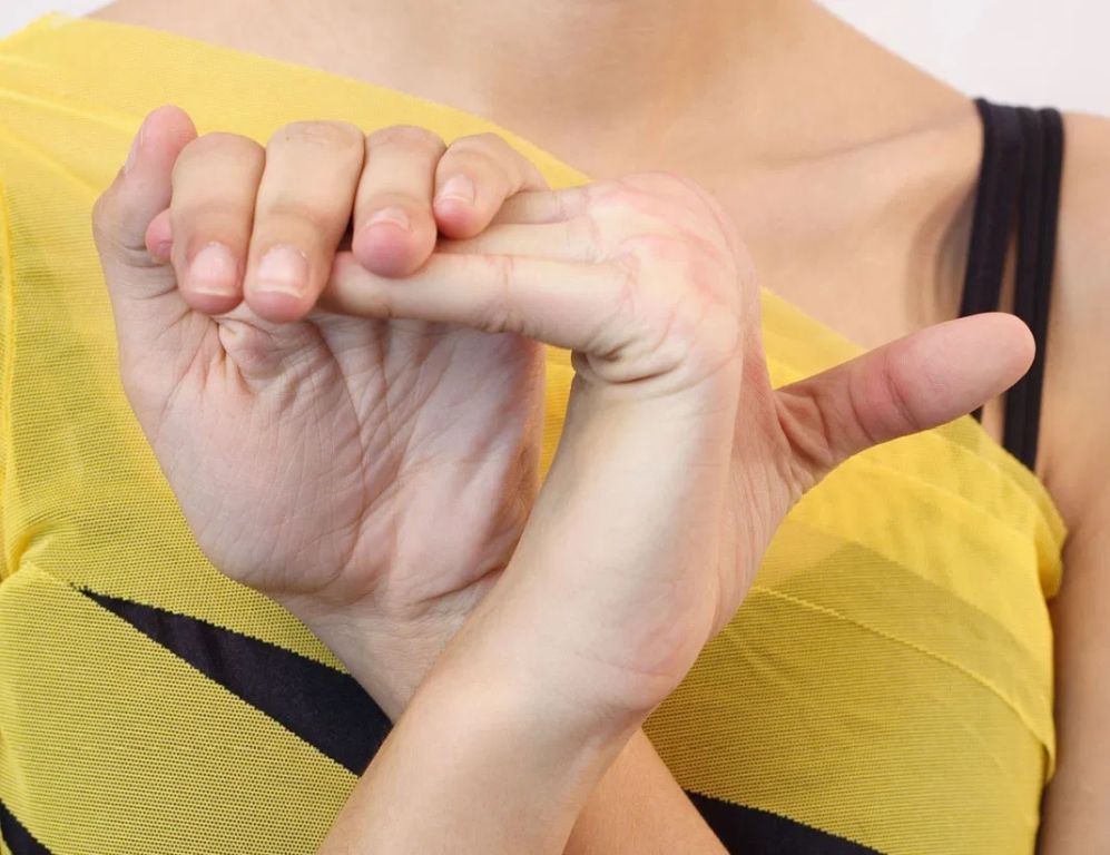 What is hypermobility and how is it treated from physical therapy?